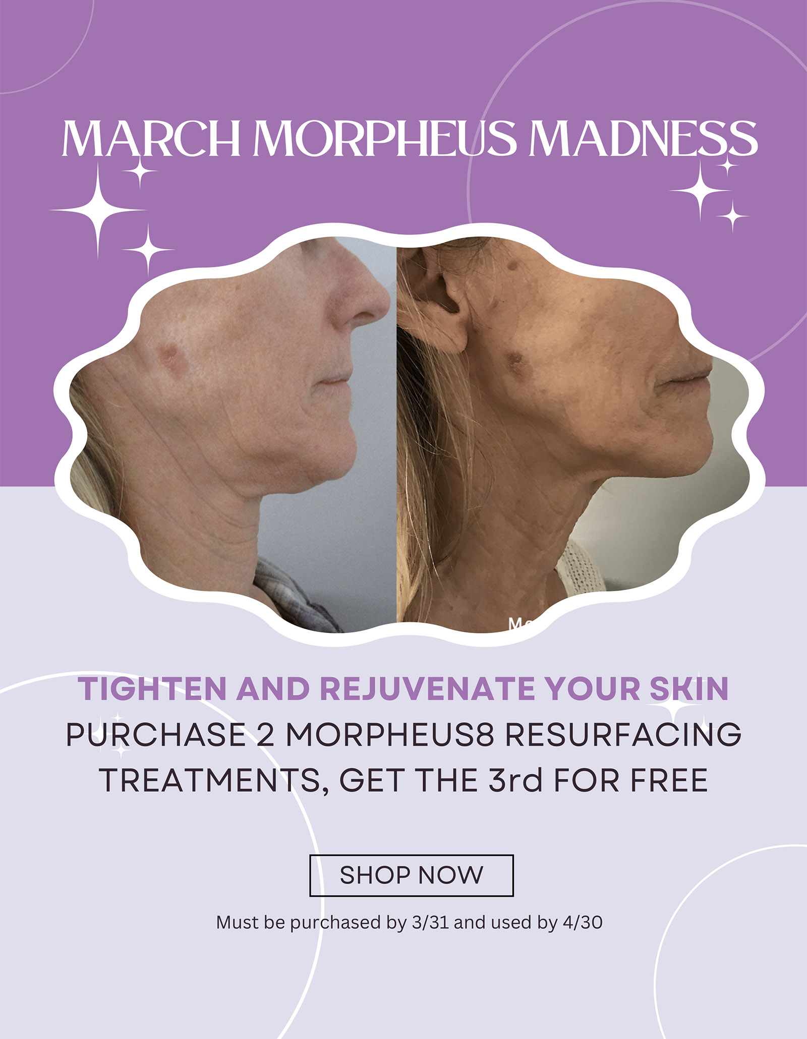 Special Medspa Offers | Female Pelvic Health